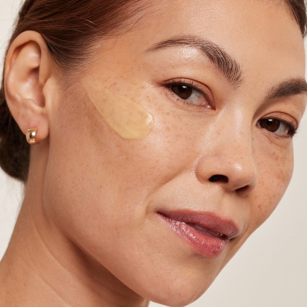 Vitamin C or Malassezin? Meet Your New Hyperpigmentation Solution ...