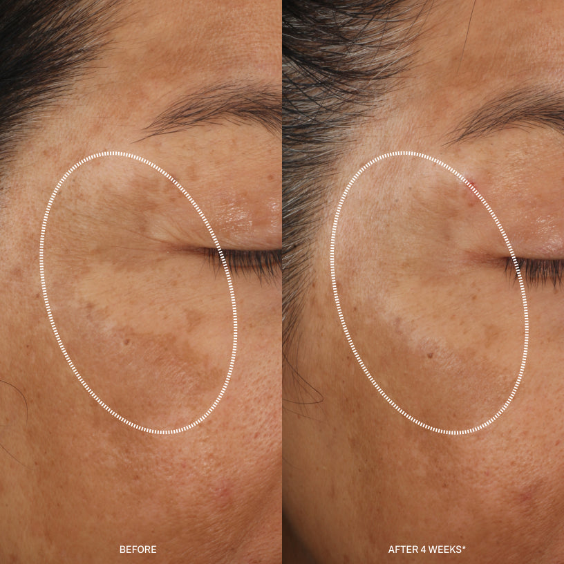 Malassezin: The Skin Brightening Ingredient | Mother Science