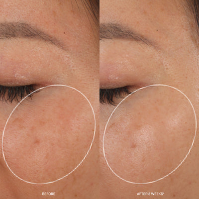 Malassezin: The Skin Brightening Ingredient | Mother Science