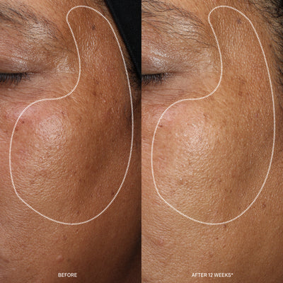 Malassezin: The Skin Brightening Ingredient | Mother Science