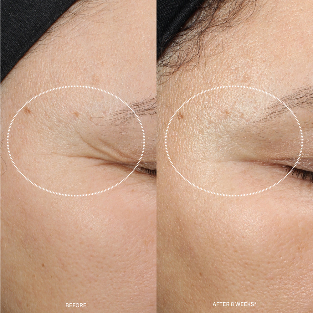 Malassezin: The Skin Brightening Ingredient | Mother Science