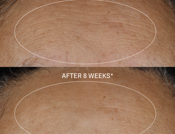 Malassezin: The Skin Brightening Ingredient | Mother Science