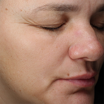 Malassezin: The Skin Brightening Ingredient | Mother Science